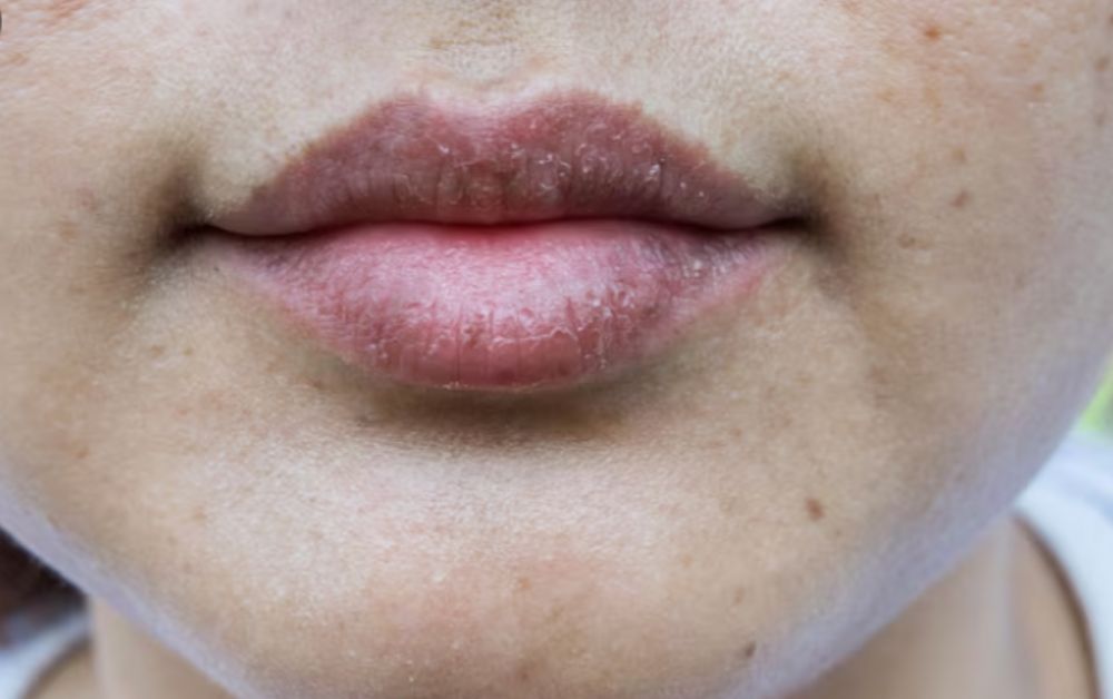 Mencerahkan Bibir Gelap: Penyebab dan Cara Mengatasinya!