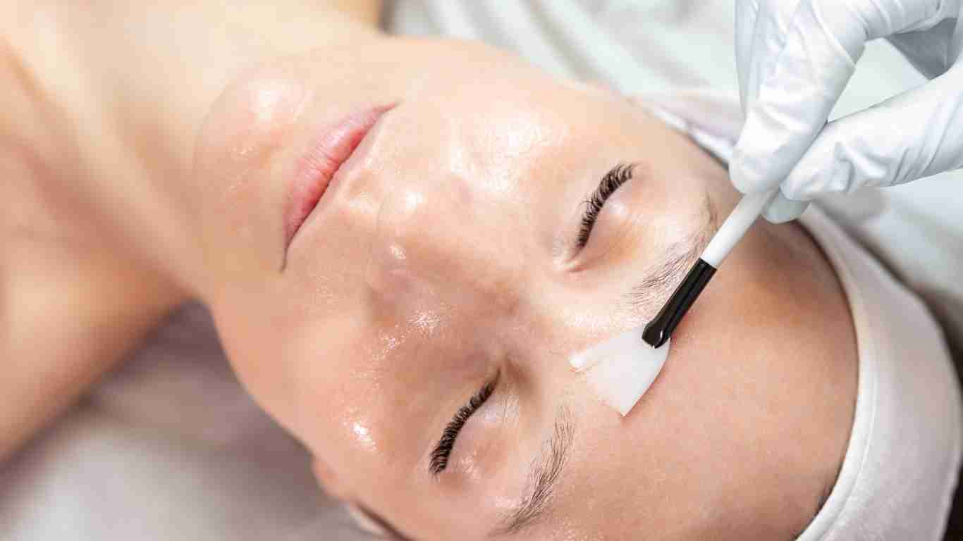 Pelajari Manfaat, Jenis dan Proses Chemical Peeling Wajah